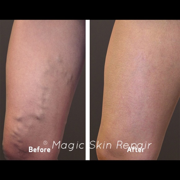 Magic Skin Repair | Other | Magic Skin Repair Oil | Poshmark